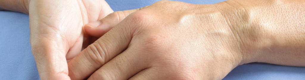 Hand Swelling Treatment North Shore | Hand Therapy Experts